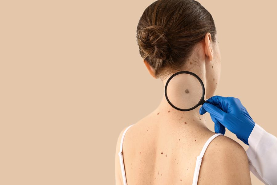 Mole Mobile - Mole Mobile Mobile Cancer Unit